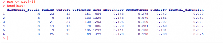KNN Algorithm | KNN In R | KNN Algorithm Example